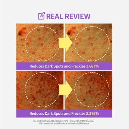 SUNGBOON EDITORMeoru Podo Vita Turn-Over Dark Pad - Glow Time